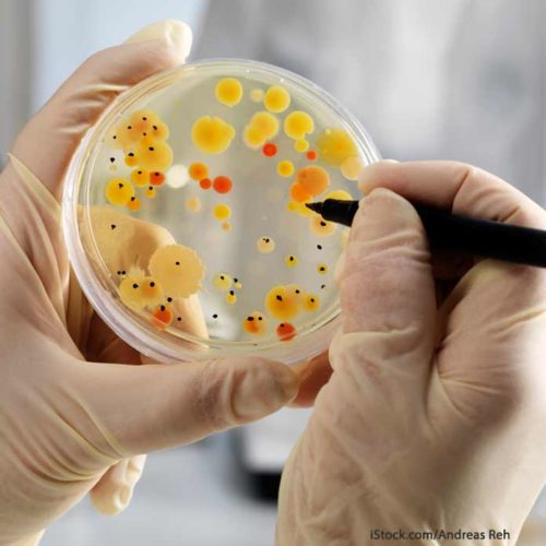 E. coli Linked to Olympus Duodenoscope Used at University of Colorado ...