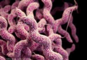 Campylobacter Complications