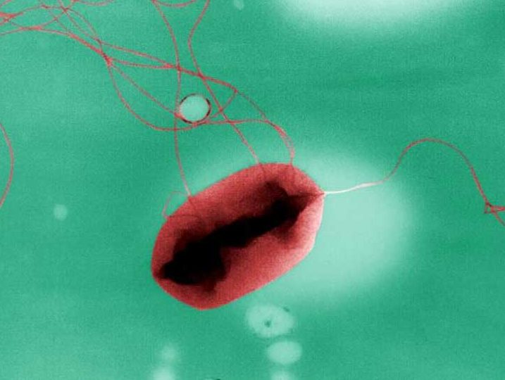 E. coli-HUS and Central Nervous System (CNS) Damage