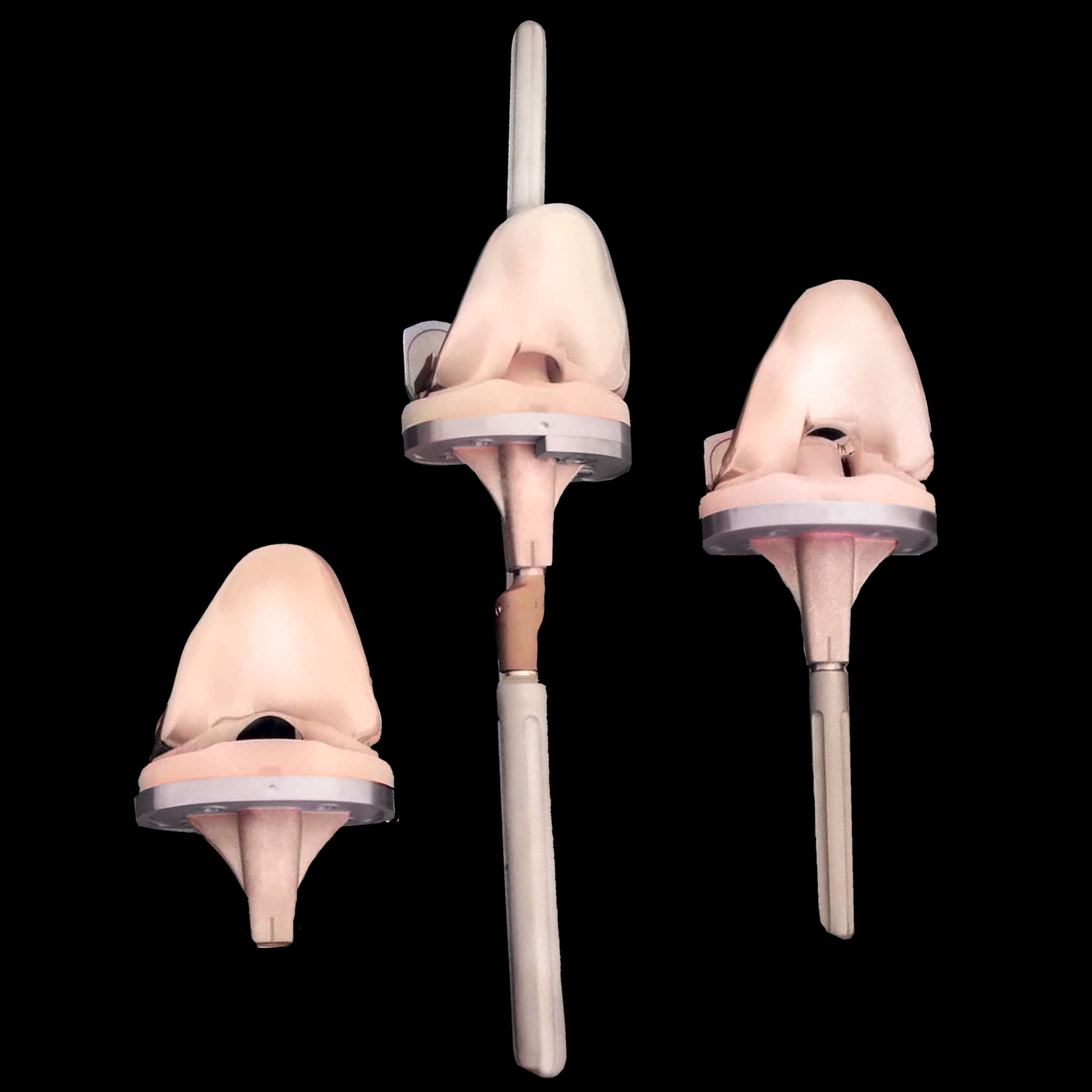 Lawsuits Follow EXACTECH Recall for Hip, Knee, and Ankle Replacement ...